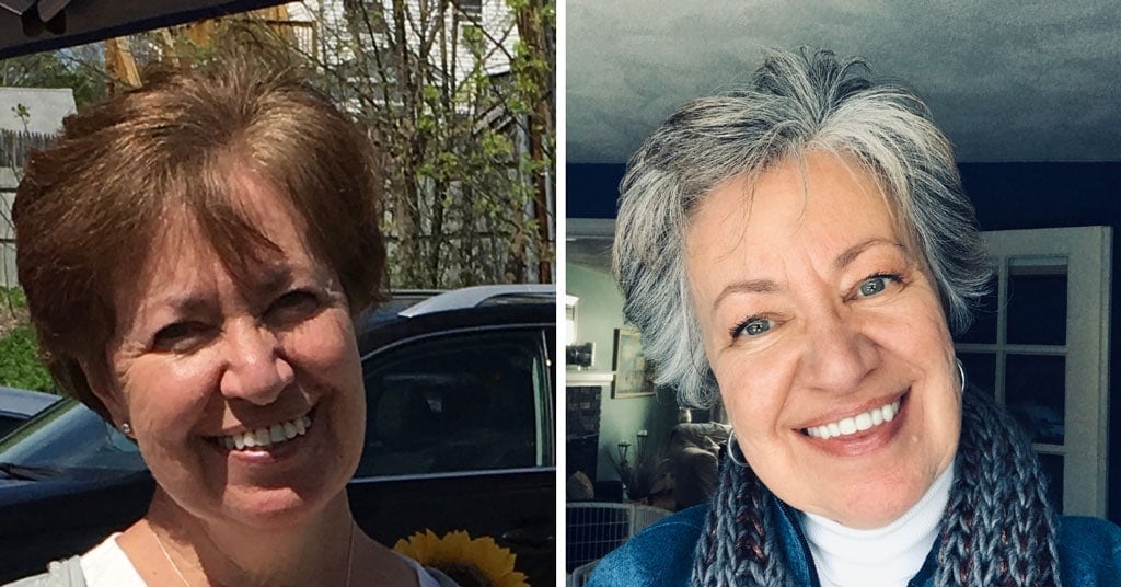 30 Gray Hair Before and After Pix that Will Blow Your Mind